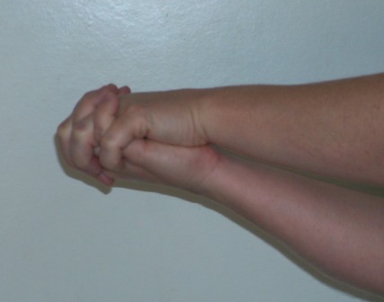 Arm Passive Range of Motion for Stroke Patients